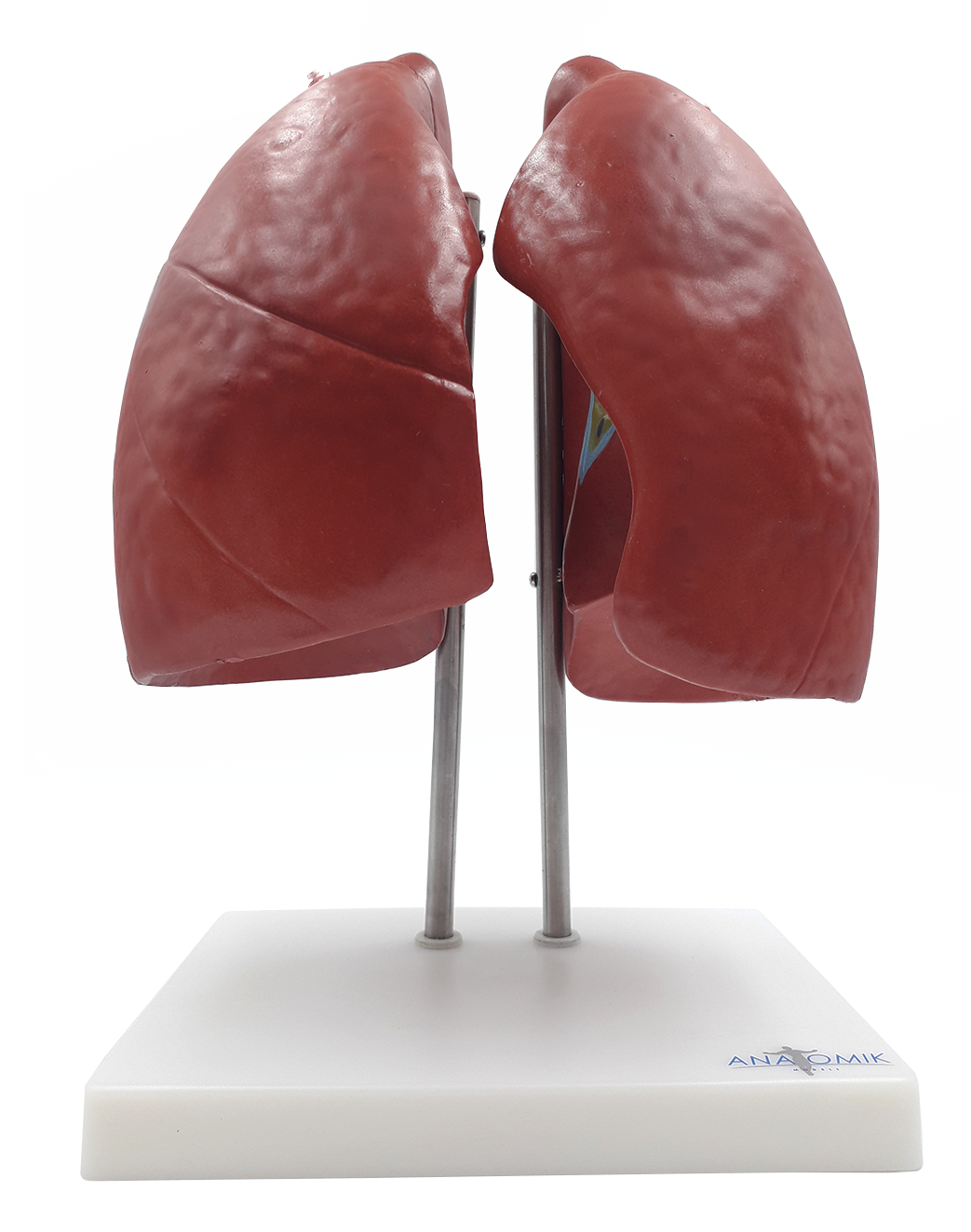 Modelo De Pulmón Tratamiento Del Cáncer De Pulmón De Células No