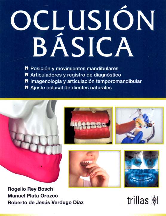 Bosch. Oclusión básica en LALEO