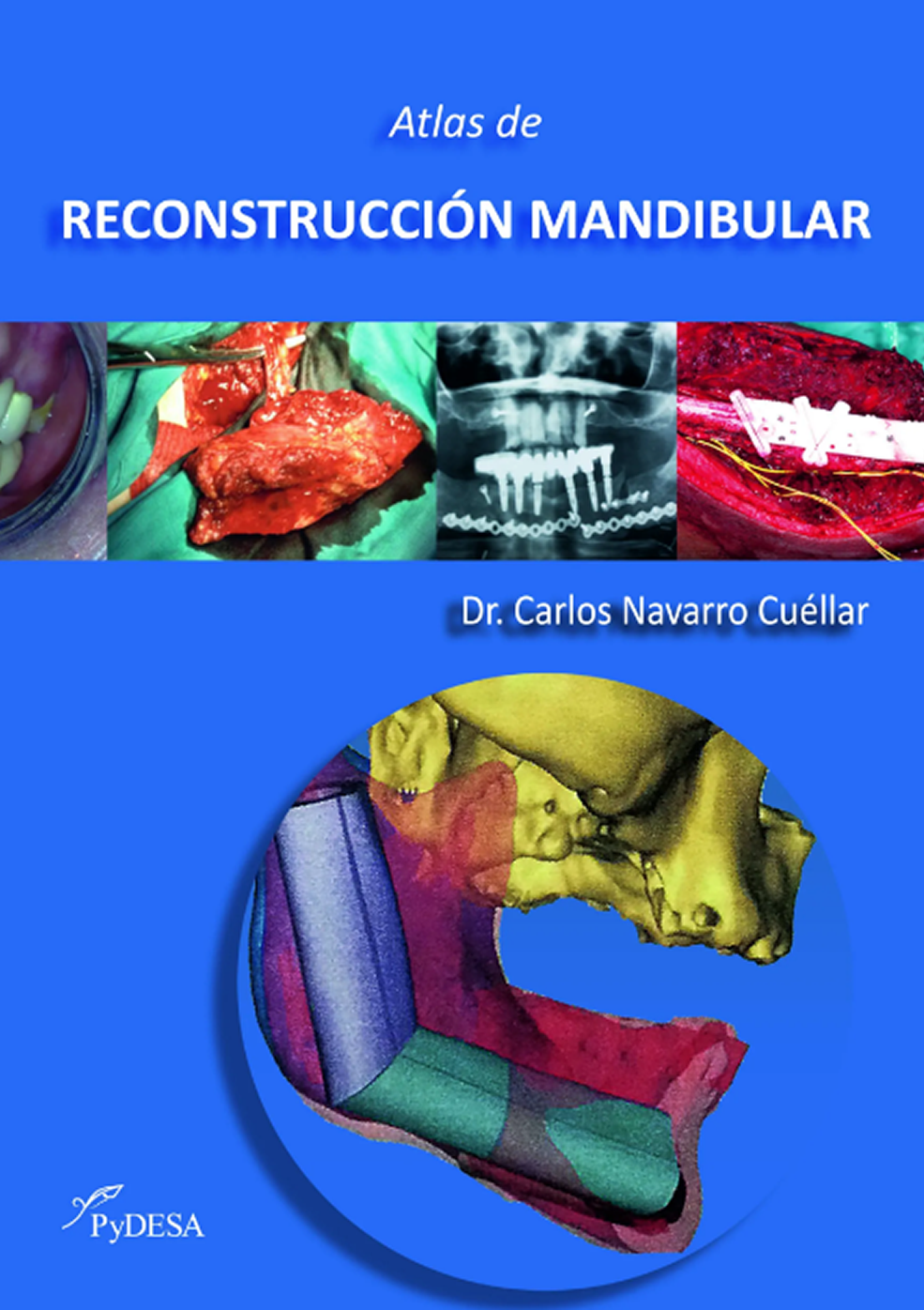 Atlas de reconstrucción mandibular en LALEO