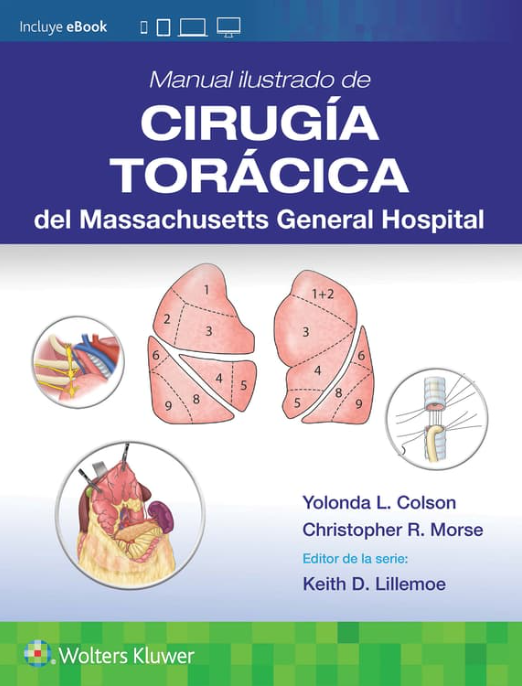Manual ilustrado de Cirugía torácica del Massachusetts General Hospital en LALEO