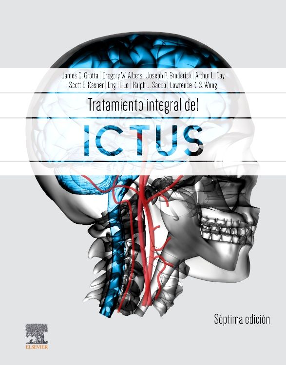 Tratamiento Integral del Ictus en LALEO