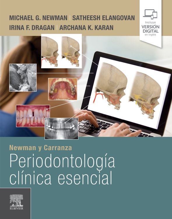 Newman y Carranza. Periodontología Clínica Esencial en LALEO