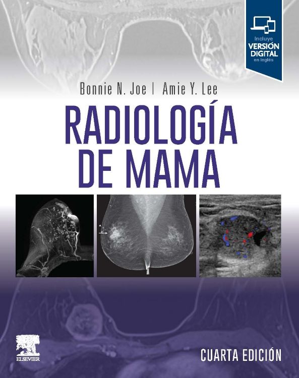 Radiología de Mama en LALEO