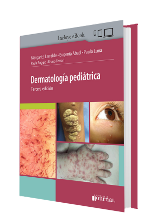 Dermatología pediátrica en LALEO