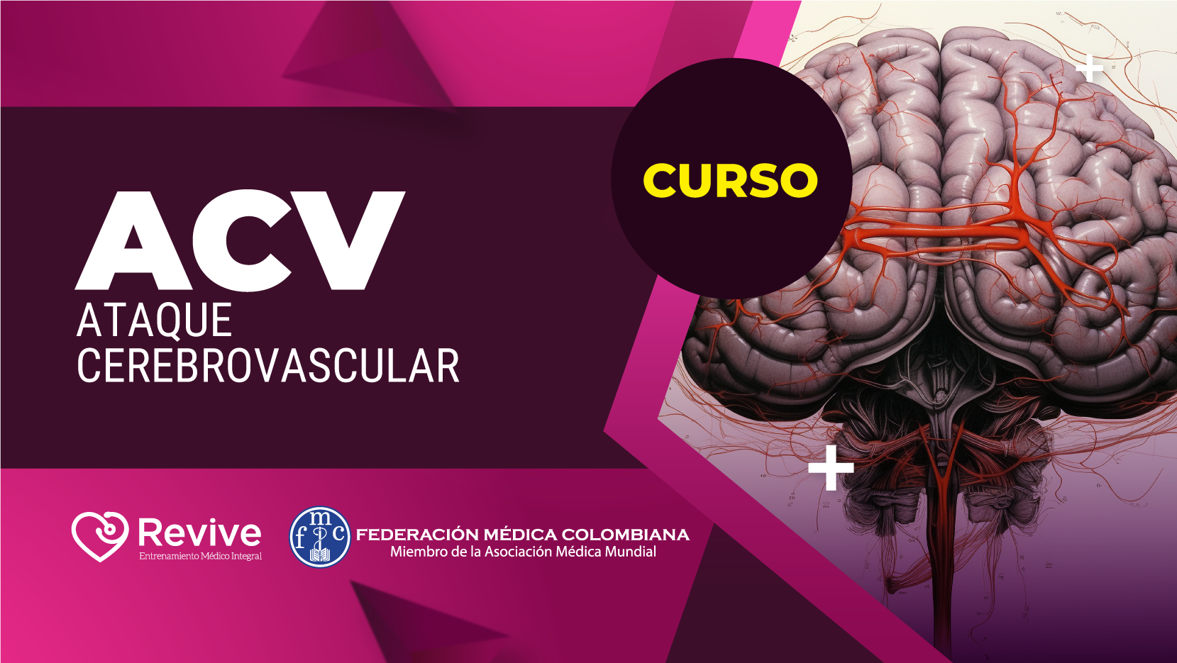 Curso Virtual de Ataque Cerebrovascular ACV en LALEO
