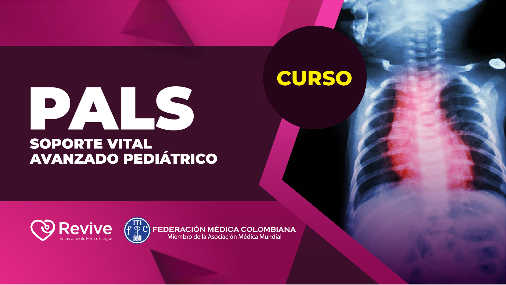 PALS - Soporte Vital Avanzado Pediátrico en LALEO