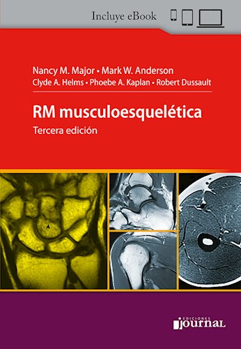 RM musculoesquelética en LALEO