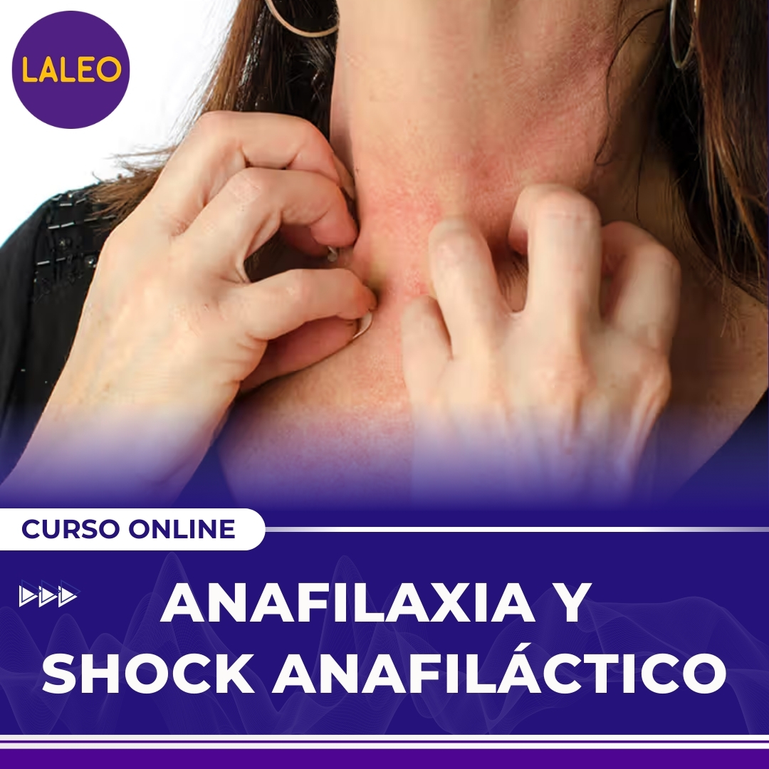 Anafilaxia y Shock Anafiláctico en LALEO