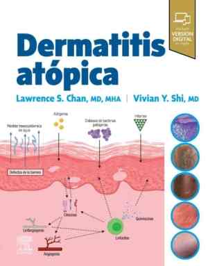 Dermatitis Atópica en LALEO