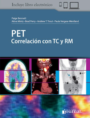 PET Correlación con TC y RM en LALEO