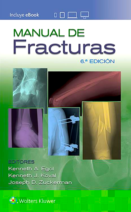 Egol. Manual de Fracturas en LALEO