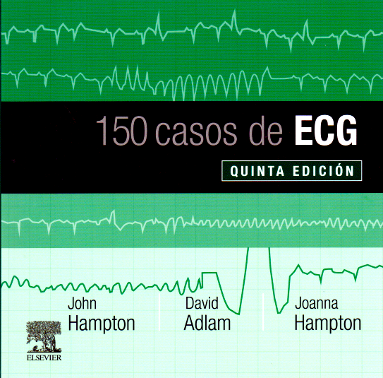 Hampton. 150 casos de ECG en LALEO