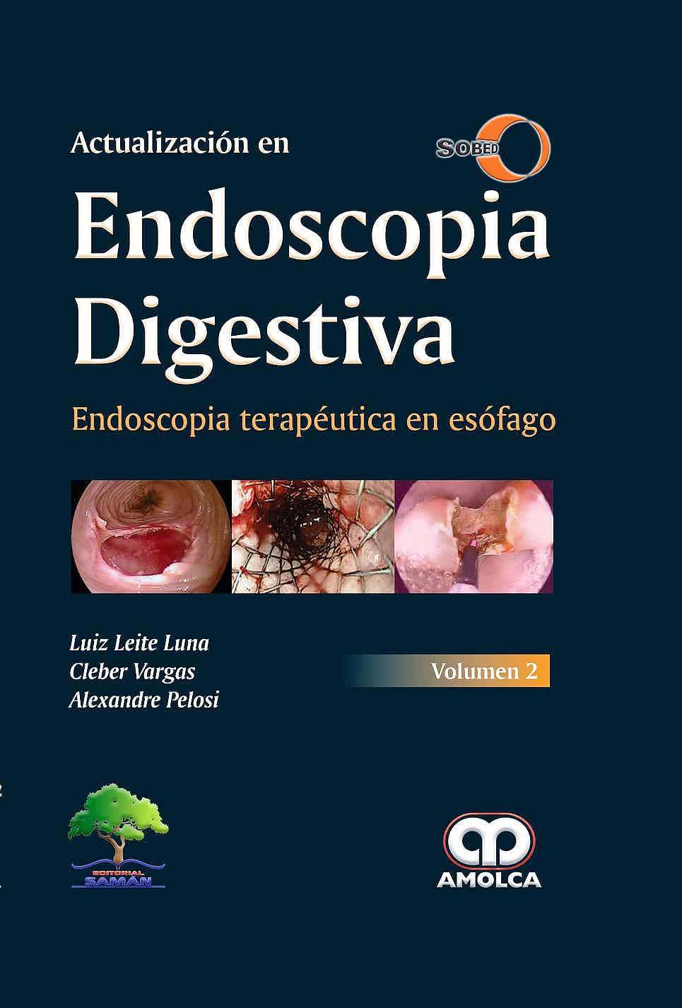 Qu Es Una Esofagogastroduodenoscopia O Endoscopia Gastrointestinal