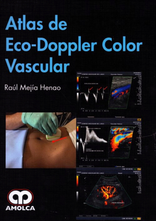 Mejía. Atlas de Eco-Doppler Color Vascular en LALEO