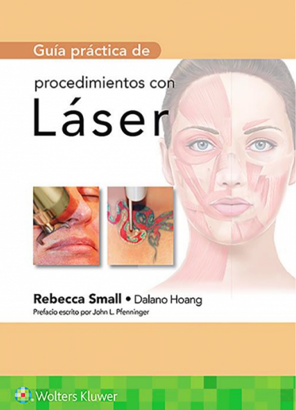 Small. Guía práctica de procedimientos con láser en LALEO