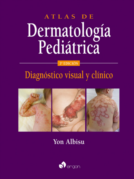Albisu, Atlas de dermatología pediátrica en LALEO Albisu, Atlas de dermatología pediátrica en LALEO