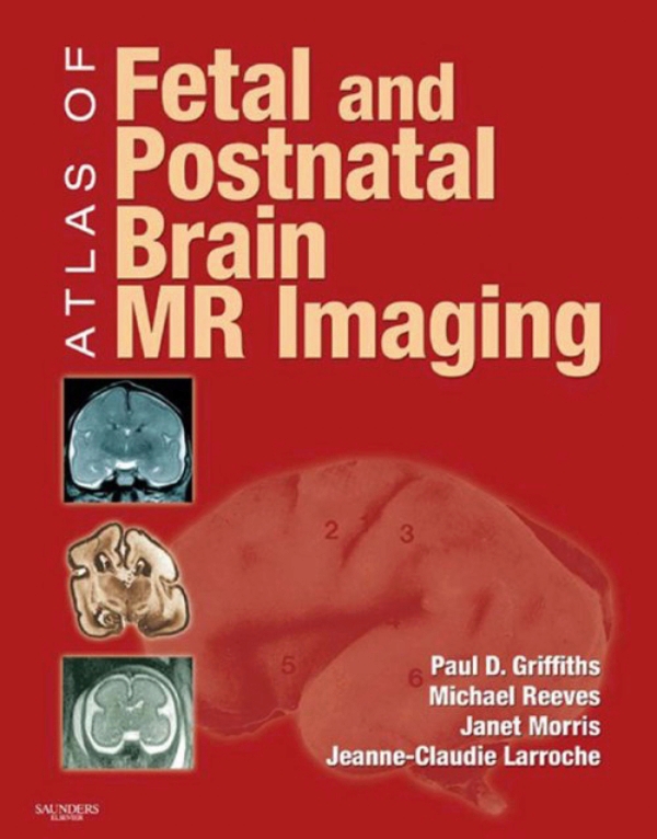 Atlas Of Fetal And Infant Brain Mr Ebook En Laleo