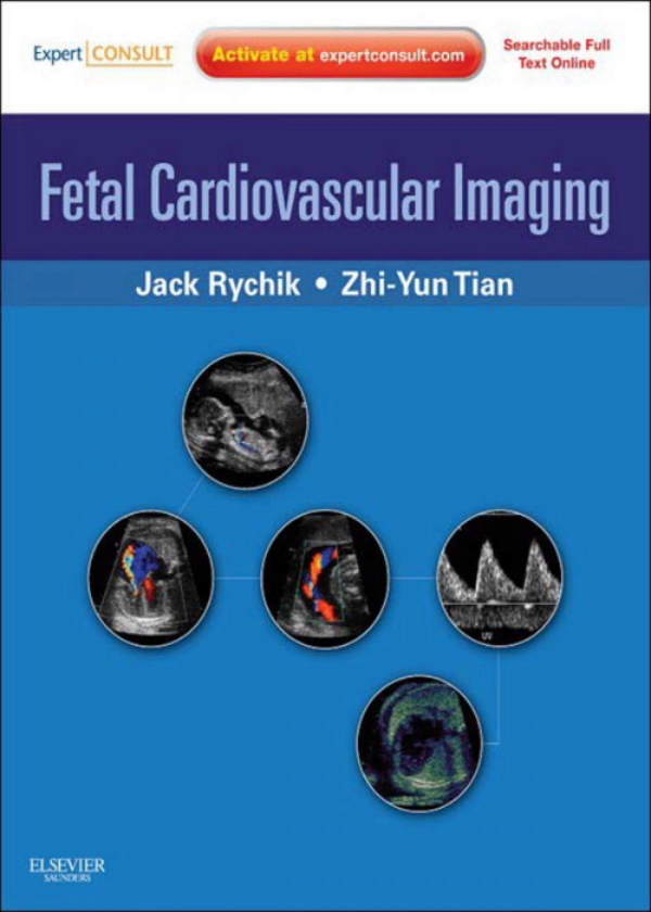 Fetal Cardiovascular Imaging (ebook) en LALEO
