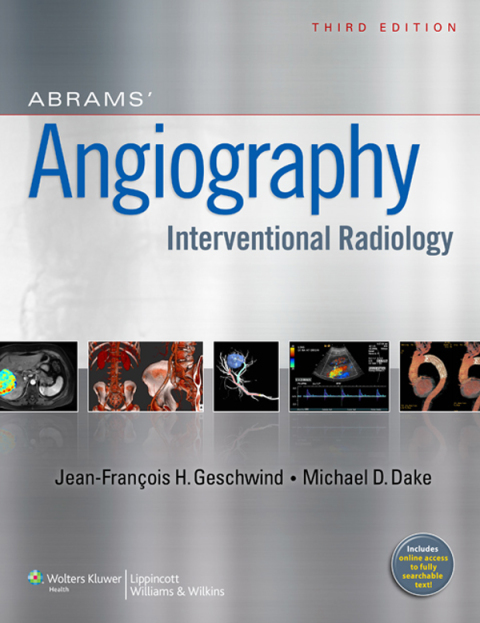Abrams Angiography (ebook) en LALEO