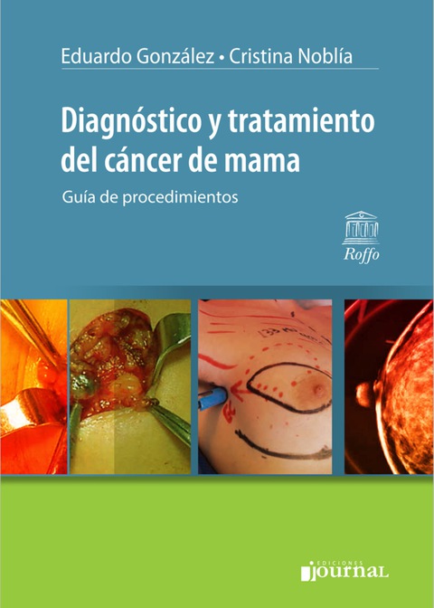 Leonora - Paciente con cáncer de mama avanzado