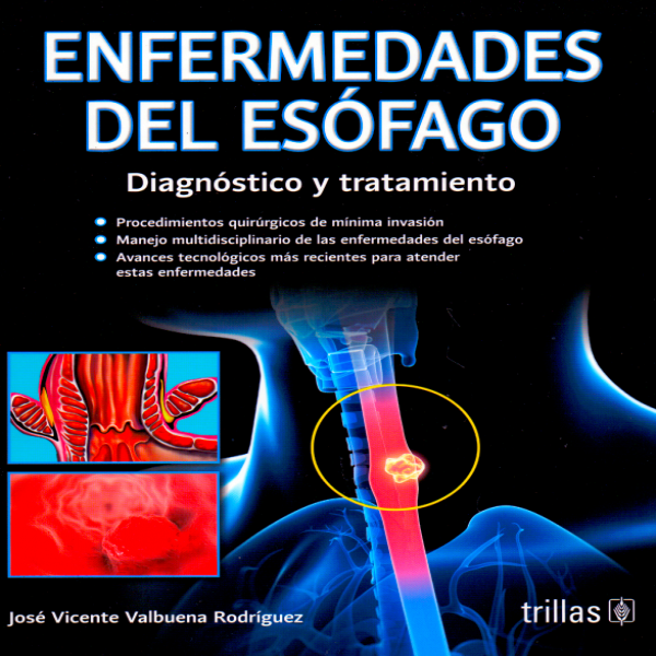 Enfermedades Del Esofago