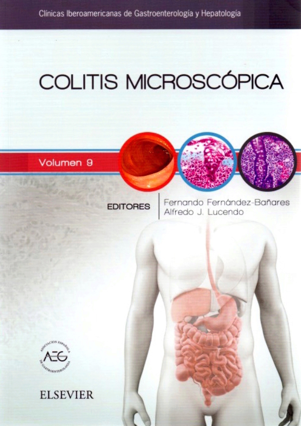 Fernández, CIGH. Colitis microscópica en LALEO