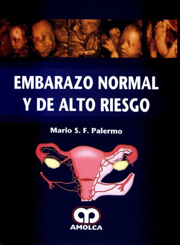 Palermo. Embarazo normal y de alto riesgo en LALEO