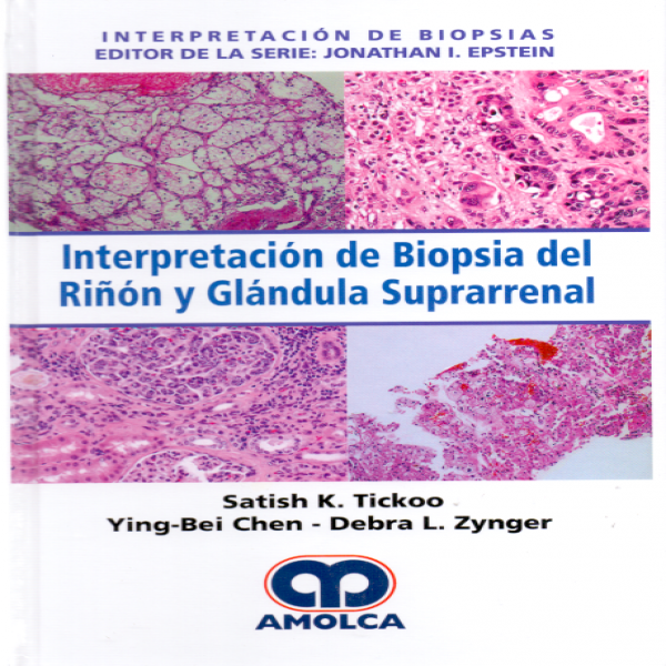 Interpretación de Biopsia del Riñón y Glándula Suprarrenal