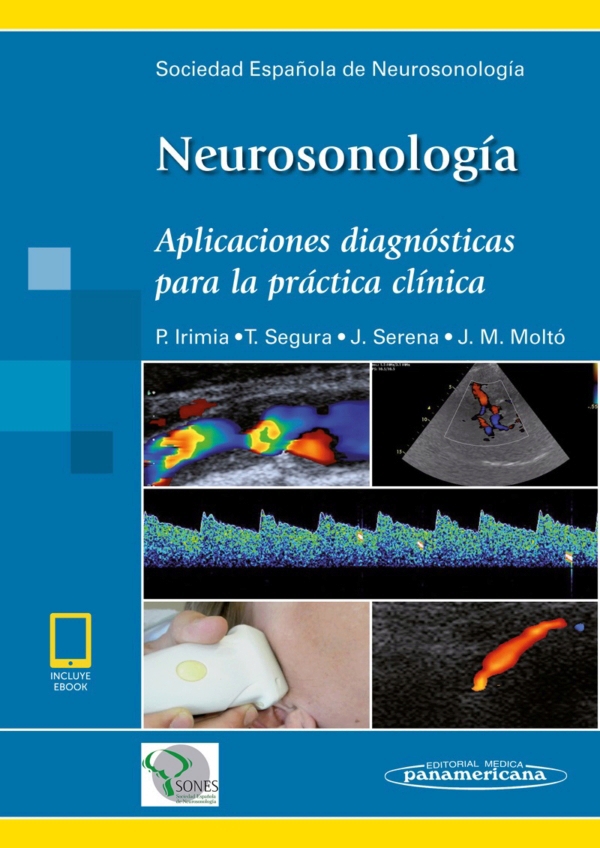 Neurosonología: Aplicaciones diagnósticas para la práctica clínica ... Neurosonología: Aplicaciones diagnósticas para la práctica clínica ...