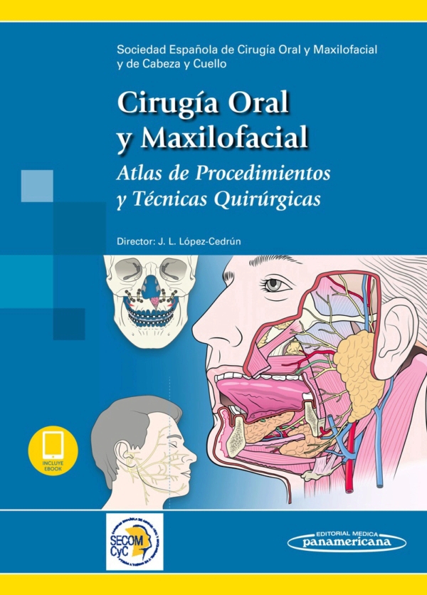 SECOM. Cirugía Oral y Maxilofacial. Atlas de procedimientos y técnicas quirúrgic en LALEO