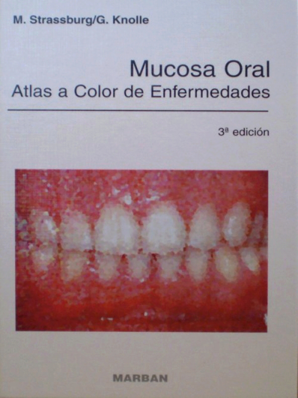 Mucosa Oral Atlas a Color de Enfermedades en LALEO