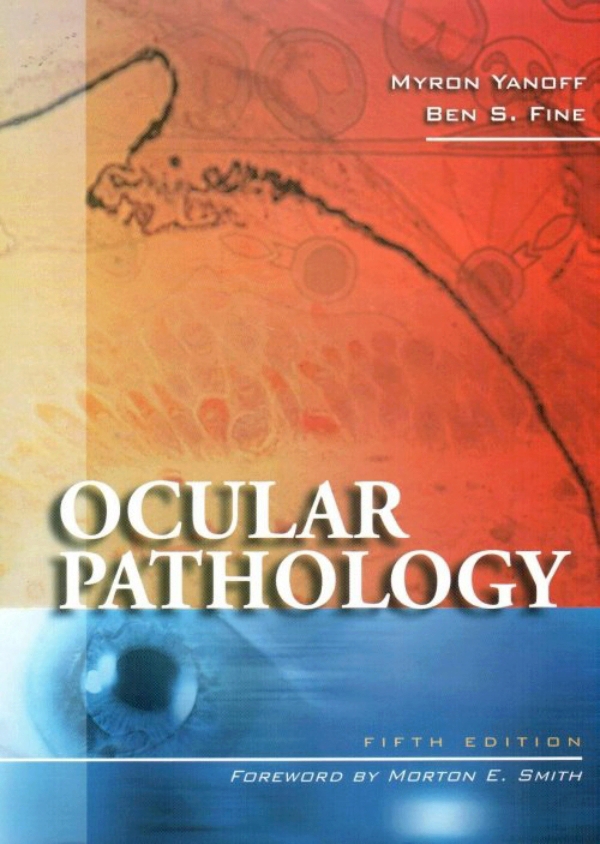 Ocular pathology en LALEO