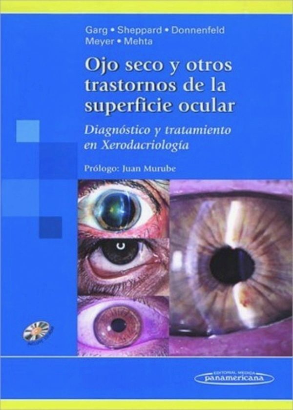 Ojo seco y otros trastornos de la superficie ocular: Diagnóstico y ...