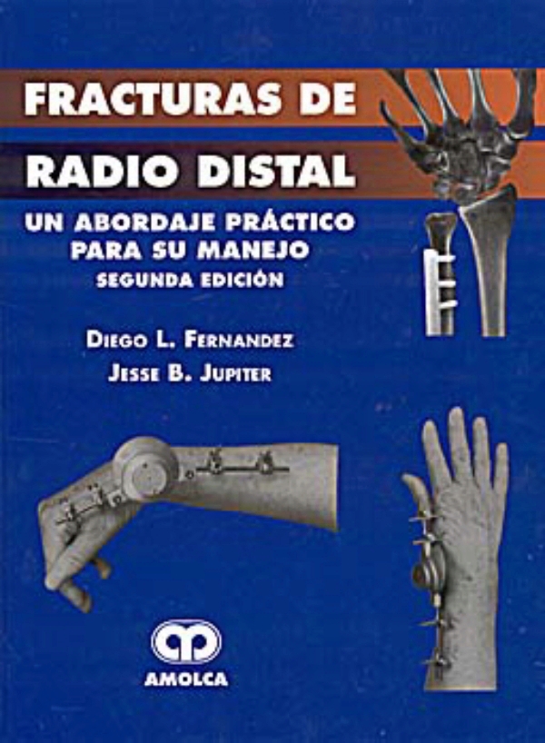 Fracturas de radio distal. Un abordaje práctico para su manejo en LALEO