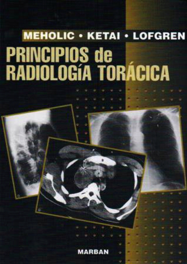 ÍNDICE Bases artefactos y variantes normales Enfermedades de vía aérea ...