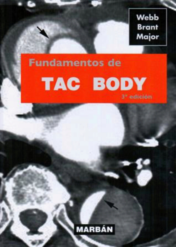 ÍNDICE 1.- Tórax 2.- Abdomen y pelvis 3.- Sistema musculoesqueletico en ...