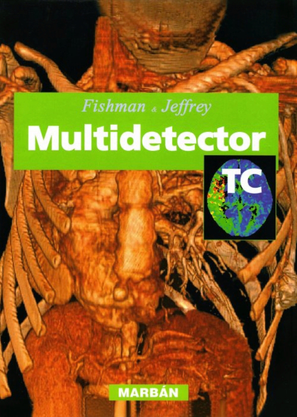 Fishman . Multidetector TC en LALEO