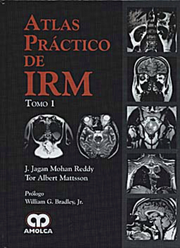 Atlas Práctico de IRM 2 vols en LALEO