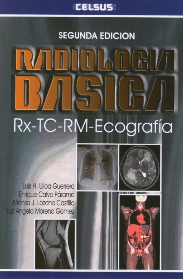 Ulloa. Radiología Básica en LALEO