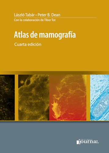 Tabar. Atlas de mamografía en LALEO