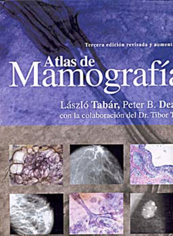 Atlas de Mamografía en LALEO