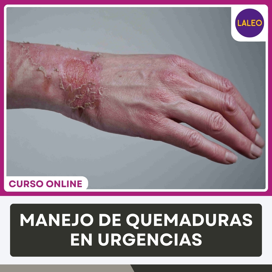 Manejo de Quemaduras en LALEO