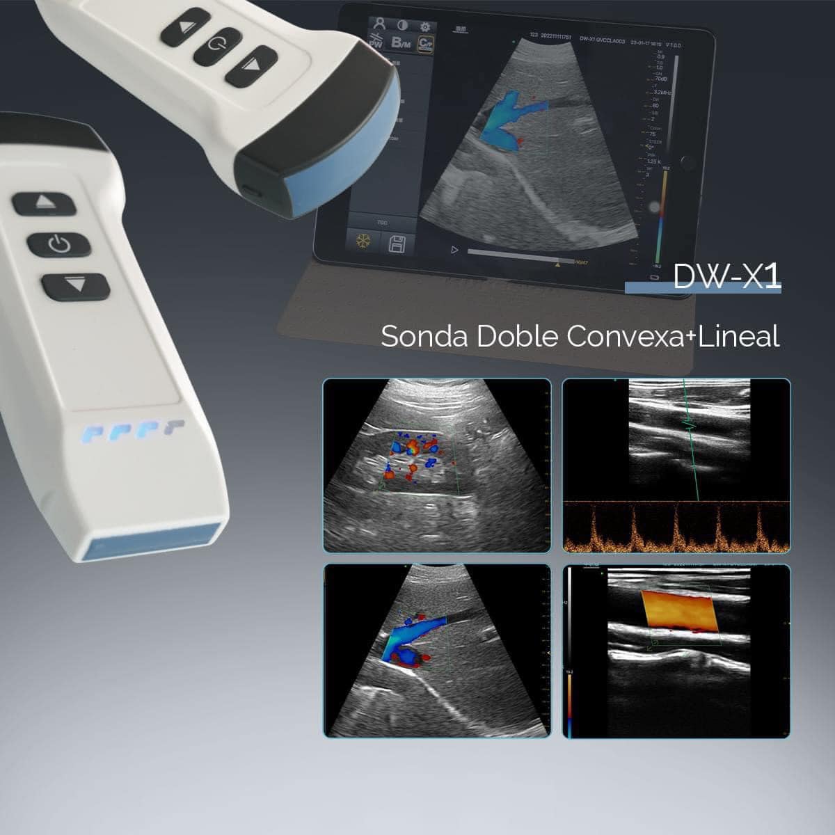 Escáner de Ultrasonido Doppler Portátil Dawei en LALEO