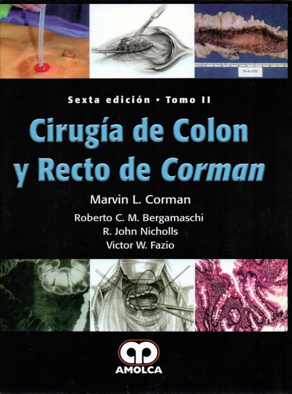 Corman. Cirugía de Colon y Recto de Corman en LALEO